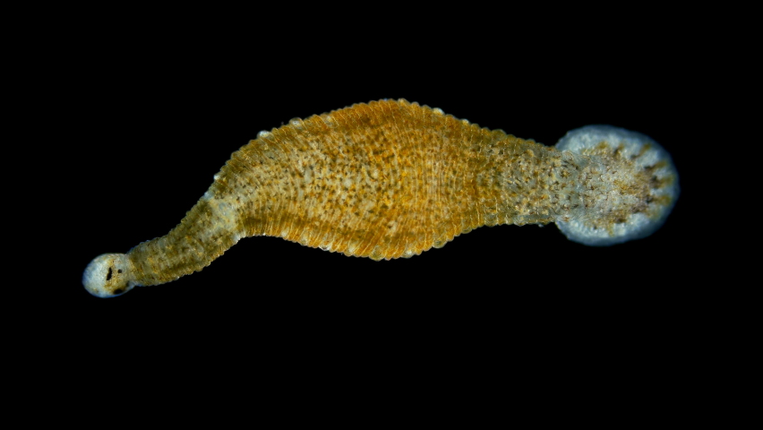 leech hirudinea baicalobdella torquata under microscope Stock Footage ...