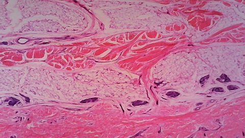 Microscope Human Skin Sweat Gland 800x Stock Footage Video (100% ...