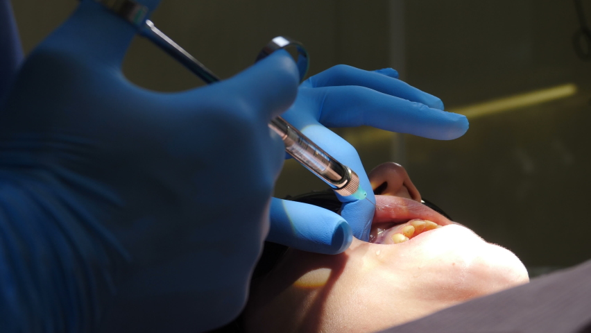 Dentist Injection Stock Video Footage - 4K and HD Video Clips ...
