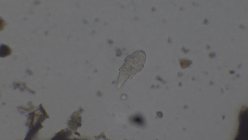 microscopy protozoa microorganisms water sample showing Stock Footage ...