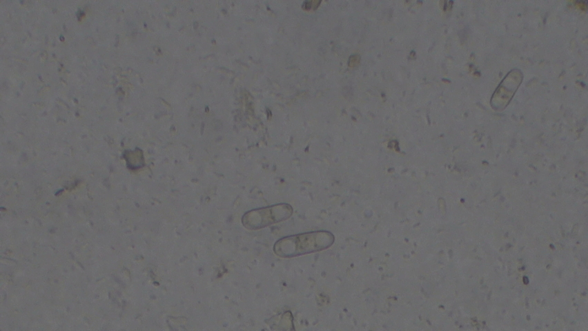 microscopy coccidia organisms rabbit feces parasite: วิดีโอสต็อก (ปลอด ...