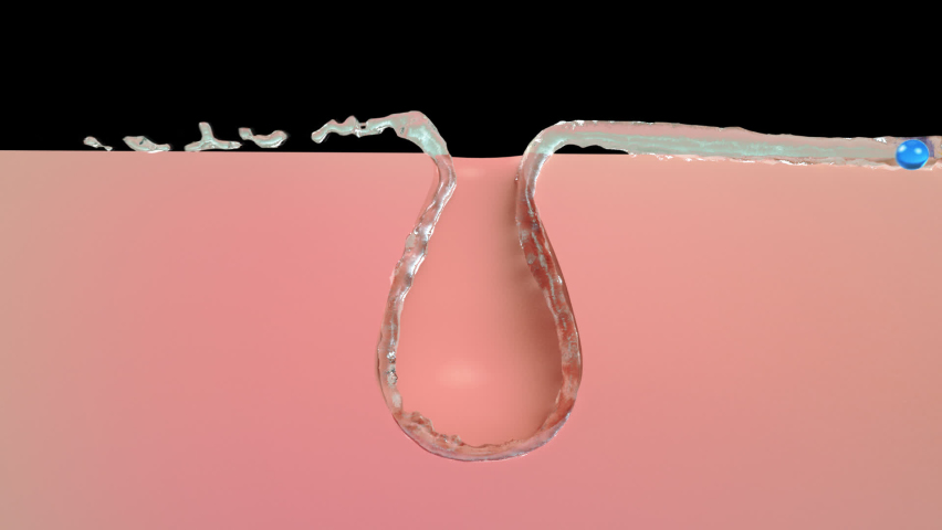 Pimple Diagram Stock Video Footage 4k And Hd Video Clips Shutterstock