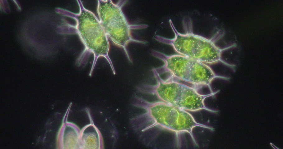 protozoa green algae waste water under Stock Footage Video (100% ...