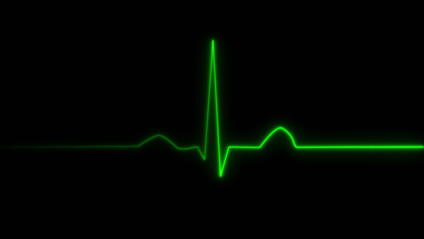 animated heart monitor ekg line sound Stock Footage Video (100% Royalty ...