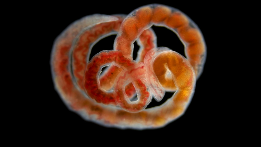 tubifex worm under microscopeoligochaeta naididae family Stock Footage ...