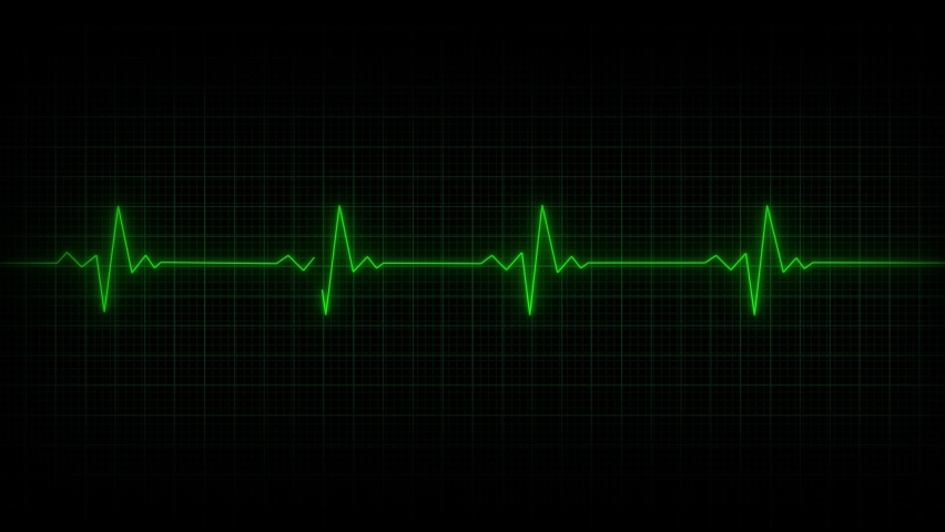 Heart Rhythm Background 4k Heartbeat Stock Footage Video (100% Royalty ...