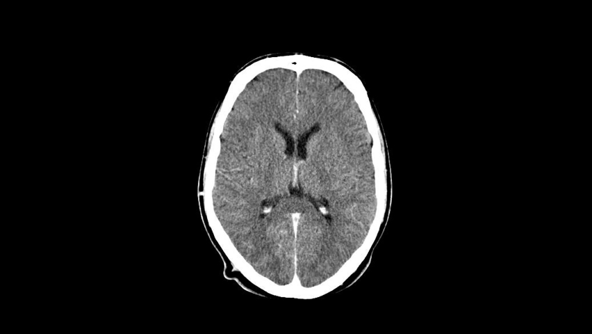Brain scan visualization footage. The device scans and displays vital ...