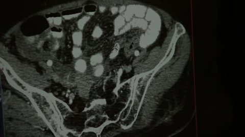 X Ray Constipation Cat Megacolon Cat Stock Photo 1260305062 | Shutterstock