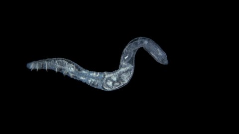 Worm Nais Sp Under Microscope Family Stock Footage Video (100% Royalty ...