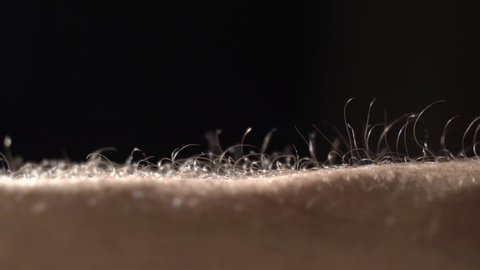 Goosebumps Close Hair On His Hand Stock Footage Video (100% Royalty ...