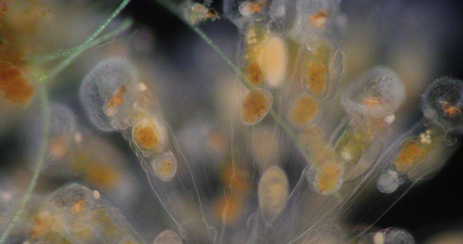 rotifer bajo el microscopio asplanchna priodonta: video de stock ...