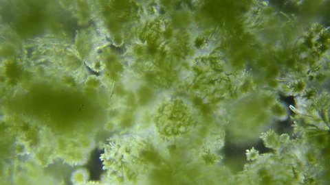 Algae On Microscope Stock Footage Video (100% Royalty-free) 10690031 ...