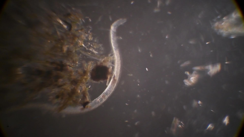 Nematode Plant Stock Video Footage - 4K and HD Video Clips | Shutterstock
