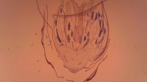 Microscope Polytrichum Archegonia Longitudinal Section X600 Stock ...