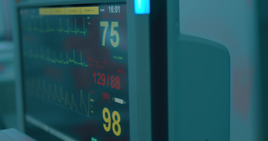 Close-up Patients Monitor Screen with Stock Footage Video (100% Royalty ...