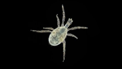 Tick Order Mesostigmata Under Microscope Possibly Stock Footage Video ...
