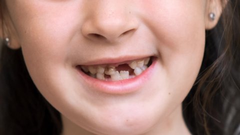 Rotten teeth child Stock Video Footage - 4K and HD Video Clips ...