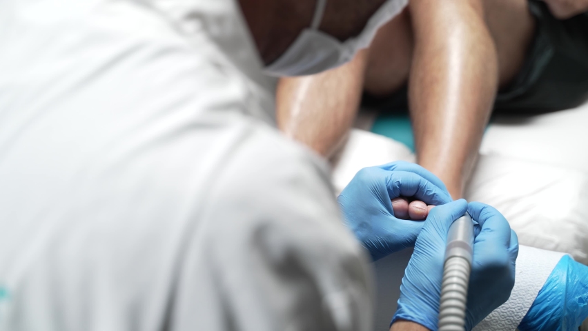 A Professional Medical Pedicure Doctor Stock Footage Video (100% ...