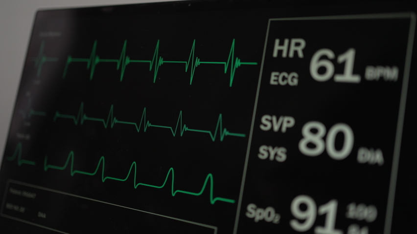 Looped: Patient Monitor Displays Vital Stock Footage Video (100% ...