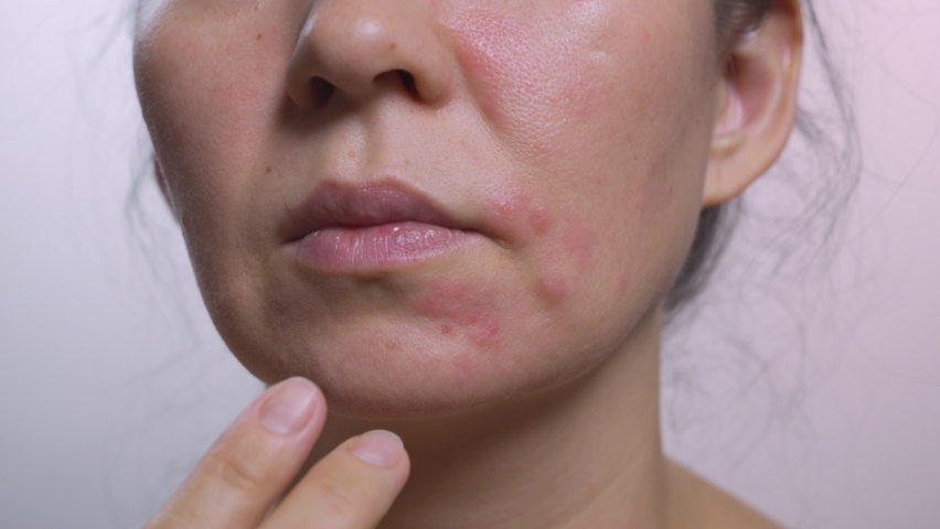 close-up woman's face skin texture problem Stock Footage Video (100% ...