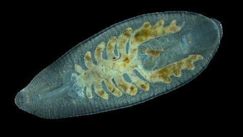 Leech Family Glossiphoniidae Under Microscope Order Stock Footage Video ...