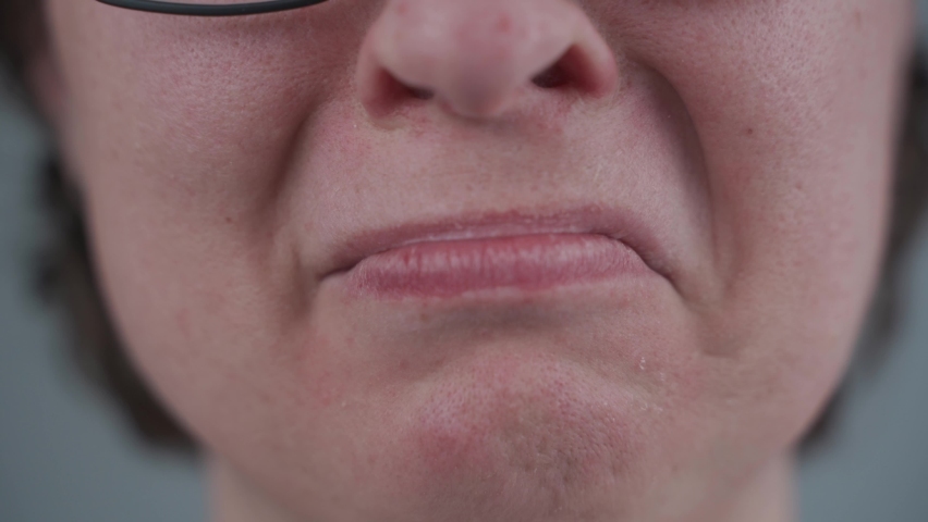 Severe bruises Stock Video Footage - 4K and HD Video Clips | Shutterstock