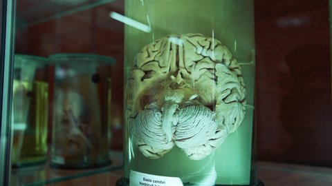 19 Human Brain Preserved Stock Video Footage - 4K and HD Video Clips ...