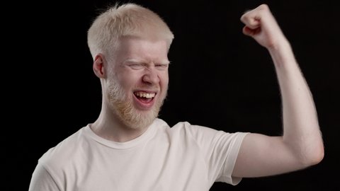 Strength Positive Albino Guy Showing Biceps Stock Footage Video (100% ...