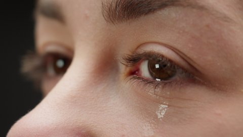 Closeup Crying Brown Eyes Watery Eye Stock Footage Video (100% Royalty ...