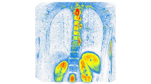 Ct scan leg Stock Video Footage - 4K and HD Video Clips | Shutterstock