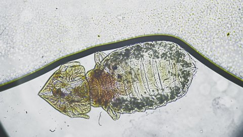 Head Lice Under Microscope Skin Flea Stock Footage Video (100% Royalty ...