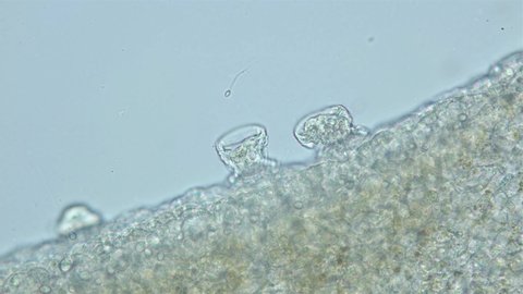 Parasitic Ciliate Family Trichodinidae Under Microscope Stock Footage ...