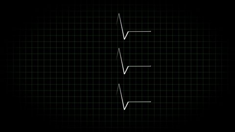 Electrocardiogram Oscilloscope Waveform Animation Motion Graphics Stock ...