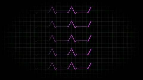 Electrocardiogram Oscilloscope Waveform Animation Motion Graphics Stock ...