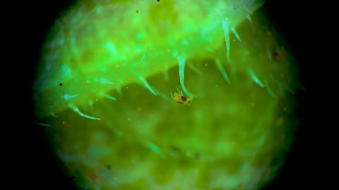 Twospotted Spider Mite Under Microscope Tetranychus Stock Footage Video ...