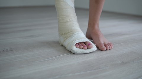 Woman Broken Foot Plaster Cast Trying Stock Footage Video (100% Royalty ...