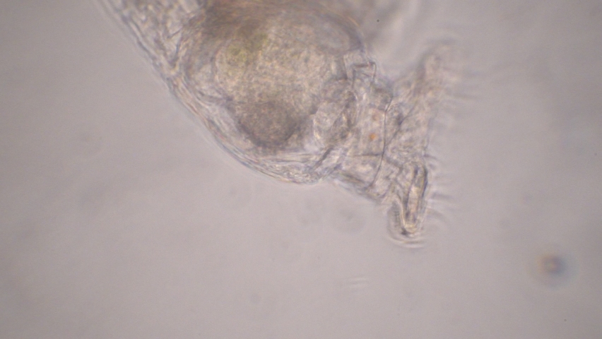 rotifer under microscope microorganism Stock Footage Video (100% ...