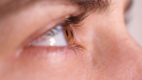 Eye Patient Keratoconus Cornea Form Cone Stock Footage Video (100% ...