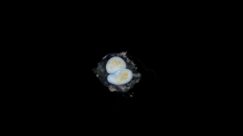 Two Ciliates Ciliophora Under Microscope Alveolata Stock Footage Video ...