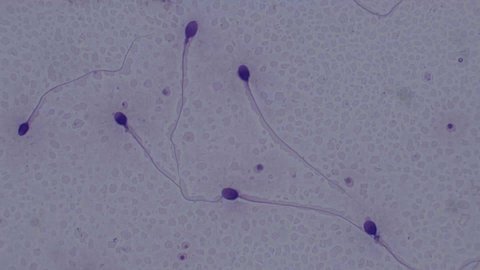 Spermiogram Test Kruger Morphology Stock Footage Video (100% Royalty ...