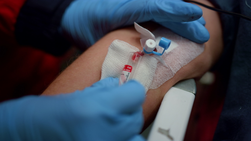 10 Man hand vein blood_test_catheter Stock Video Footage - 4K and HD ...