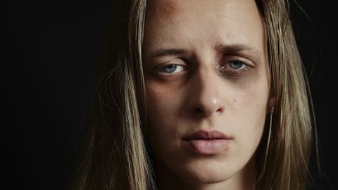 Sad Beaten Woman Wounds On Face Stock Footage Video (100% Royalty-free ...