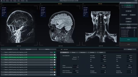 Medical Software Interface Showing Realtime Process Stock Footage Video ...