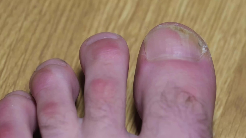 Scaly feet Stock Video Footage - 4K and HD Video Clips | Shutterstock