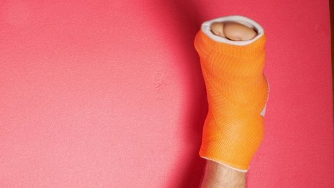 Leg cast Stock Video Footage - 4K and HD Video Clips | Shutterstock