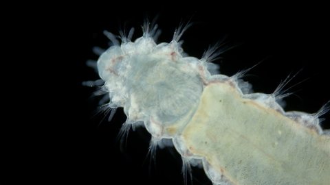 Worm Polychaeta Family Amphinomidae Under Microscope Stock Footage ...