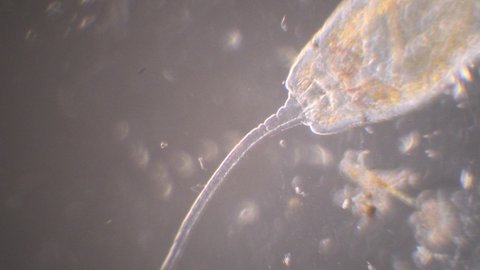 Head Worm Family Naididae Under Microscope Stock Footage Video (100% ...