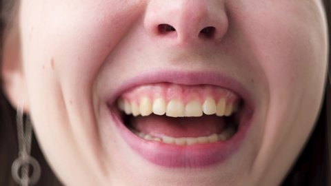 Closeup Woman Mouth Smile Laughing Stock Footage Video (100% Royalty ...