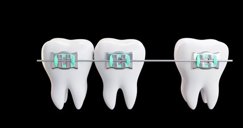 12 Orthodontic lock Stock Video Footage - 4K and HD Video Clips ...