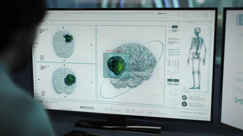 Doctor Checks Brain Patient Disease Diagnostic Stock Footage Video (100 ...